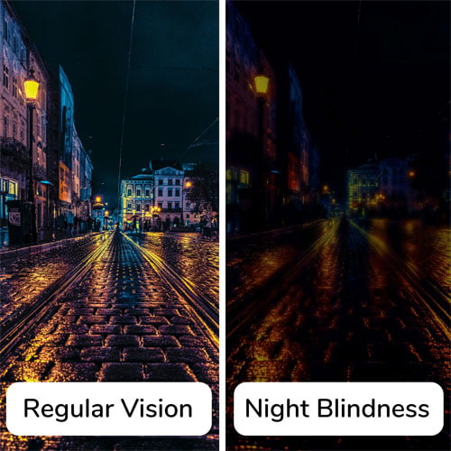 What is Night Blindness (Chicken Black)? - Plastic surgery in Istanbul