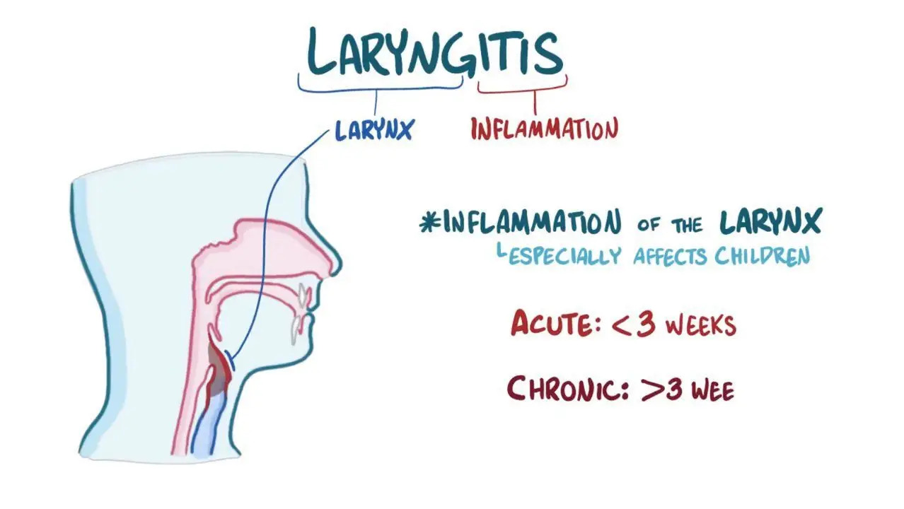 What is Laryngitis (Inflammation of the Throat)? - Plastic surgery in ...
